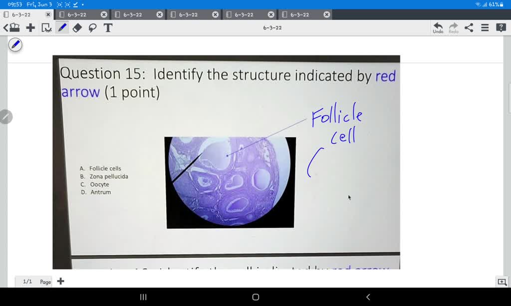 SOLVED: IQuestion 14: Identify the cell indicated by red arrow (1 point) A. Spermatid ...