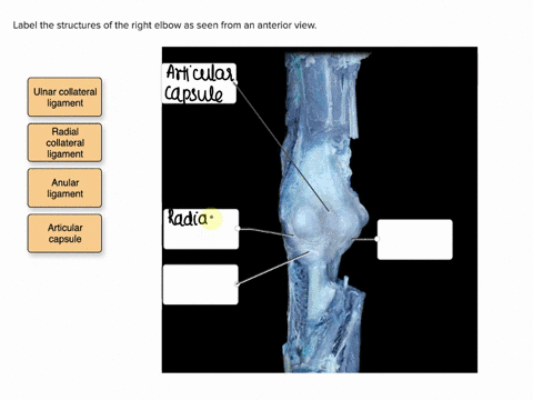 place the labels into the appropriate location in the figure humerus ...