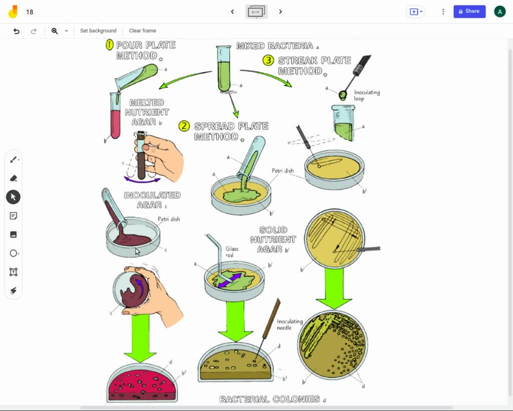 SOLVED: What are the equipment/materials used in immobilizing and ...