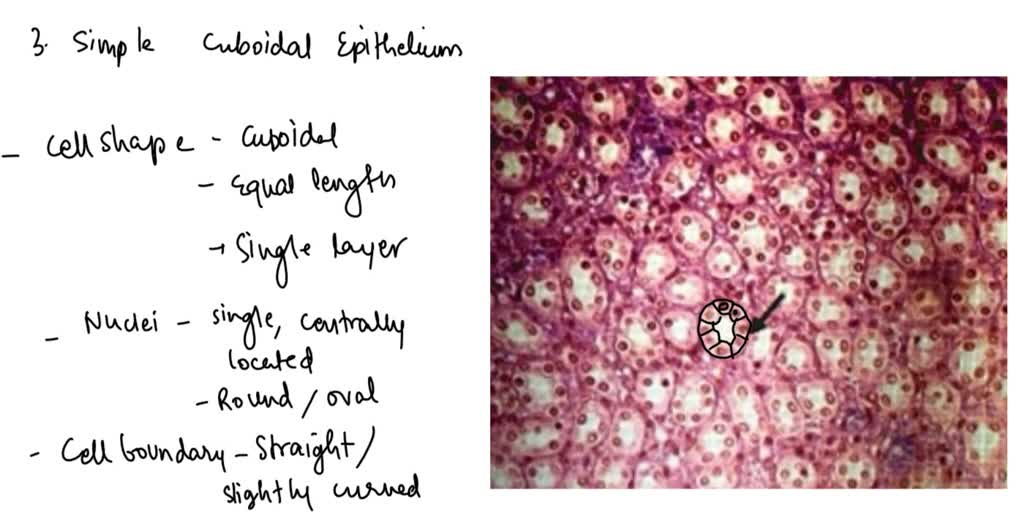 SOLVED: Identify structures found in types of simple epithelial tissue ...