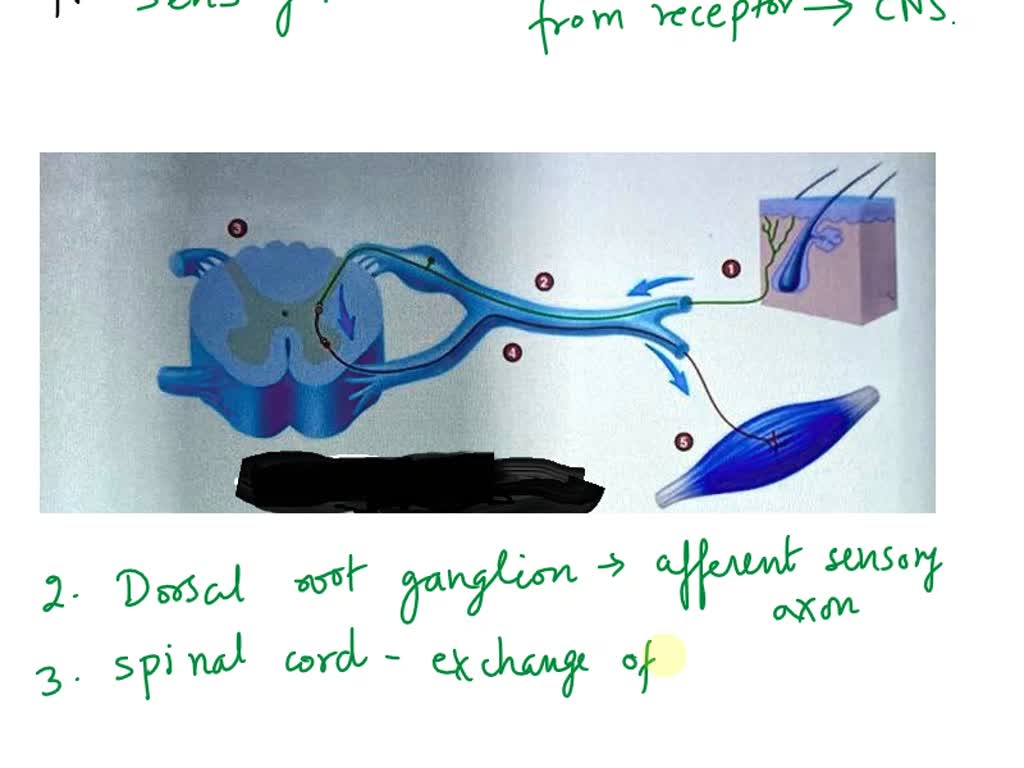 SOLVED: Activity 6: Parts of a Reflex Arc Ceantenl Annnen e [entn ...