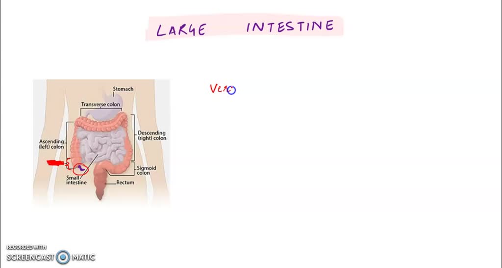 SOLVED: The vermiform appendix extends from the region of the large ...