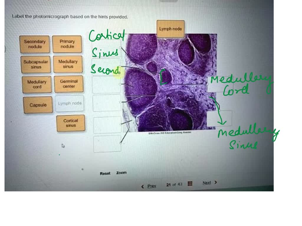 SOLVED: Capsule cord Medullary sinus Subcapsular nodule Secondary ...