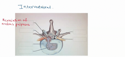 correctly label the following anatomical features of the neuroglia ...