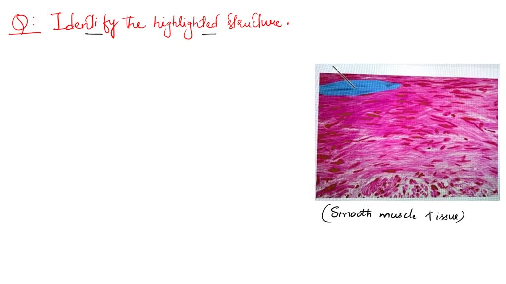 Solved Pal Histology Cardiovascular System Lab Practical Question 20 Part A Identify The 