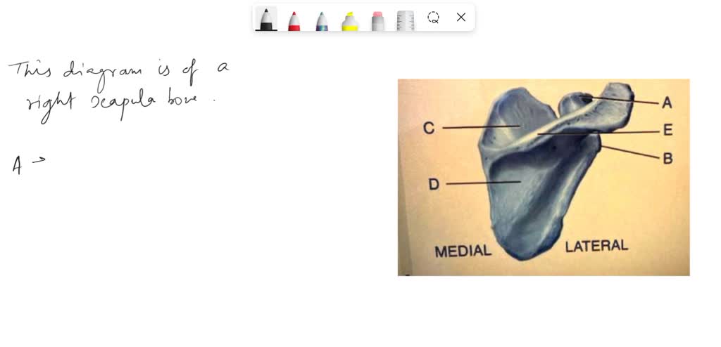 SOLVED: Question 19 (1 point) Which of the labeled structures in the ...