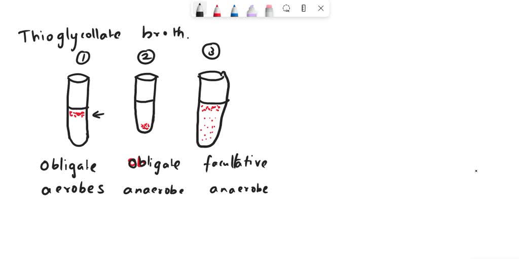 SOLVED: 5 Sketch the location of the expected growth for a typical ...