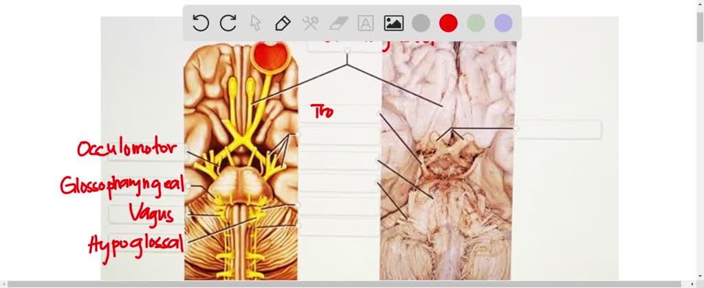 SOLVED: Facial Nerve Label the branches of the facial nerve. Trigeminal ... SOLVED: Facial Nerve Label the branches of the facial nerve. Trigeminal ...