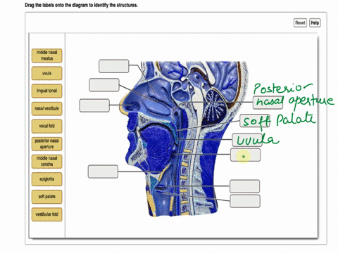 Label the following different tonsils. Pharyngeal tonsil Mandibular ...
