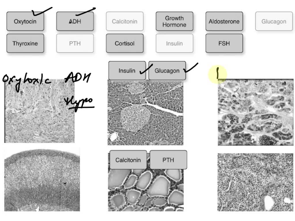 SOLVED: Below are 6 histology slides of endocrine glands. Place the ...