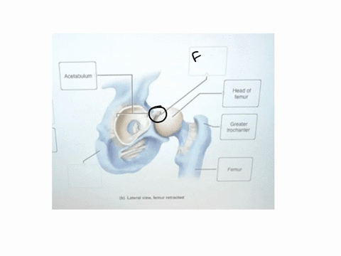 Correctly label the following anatomical features of the coxal joint ...