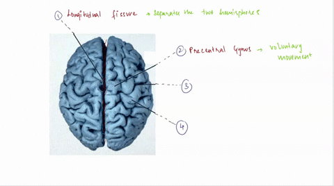 Left cerebral hemisphere Cerebellum Brain stem