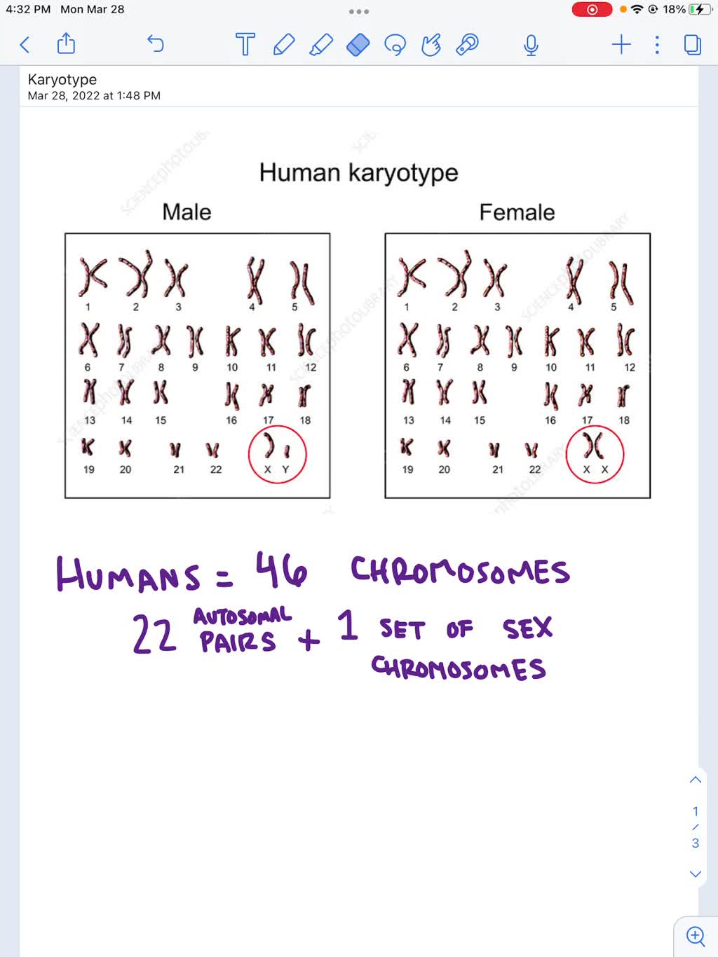 SOLVED A Normal Human Karyotype Has A 46 Chromosomes B 23