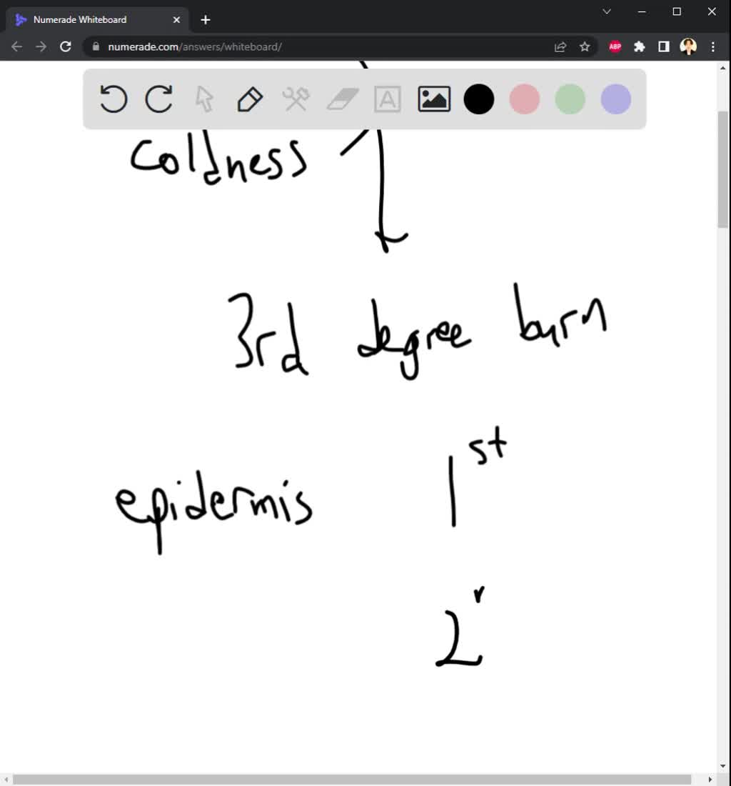 SOLVED: List the main term used to locate information in the Alphabetical Index for the ...