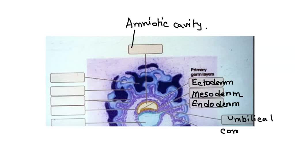 SOLVED: Label the figure identifying the extra-embryonic membranes and ...