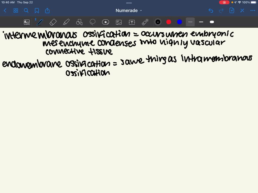 Endochondral Ossification Steps Endochondral Ossification Steps