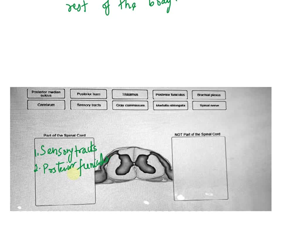 SOLVED: Texts: Cerebral a lateral nerves Pharynx transverse nerves The ...