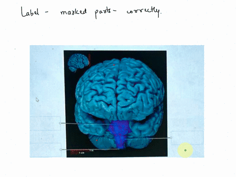 CNS and the Structures That Protect It Label the structures of the ...