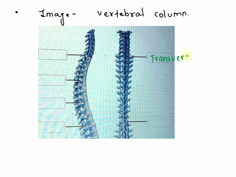 parts of the axis label the structures of the axis superior articular ...