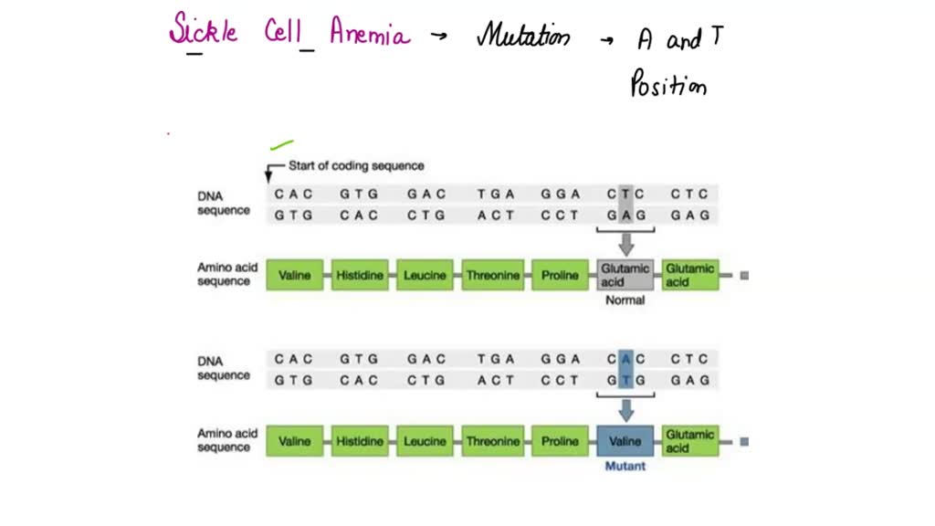SOLVED: Sickle Cell Anemia is a genetic disorder caused by a mutation ...