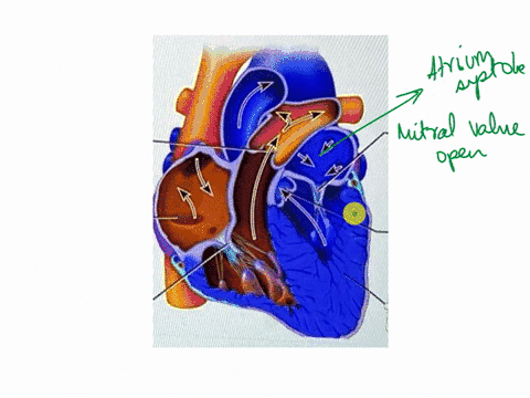 label the positioning of the valve cusps during ventricular systole and ...