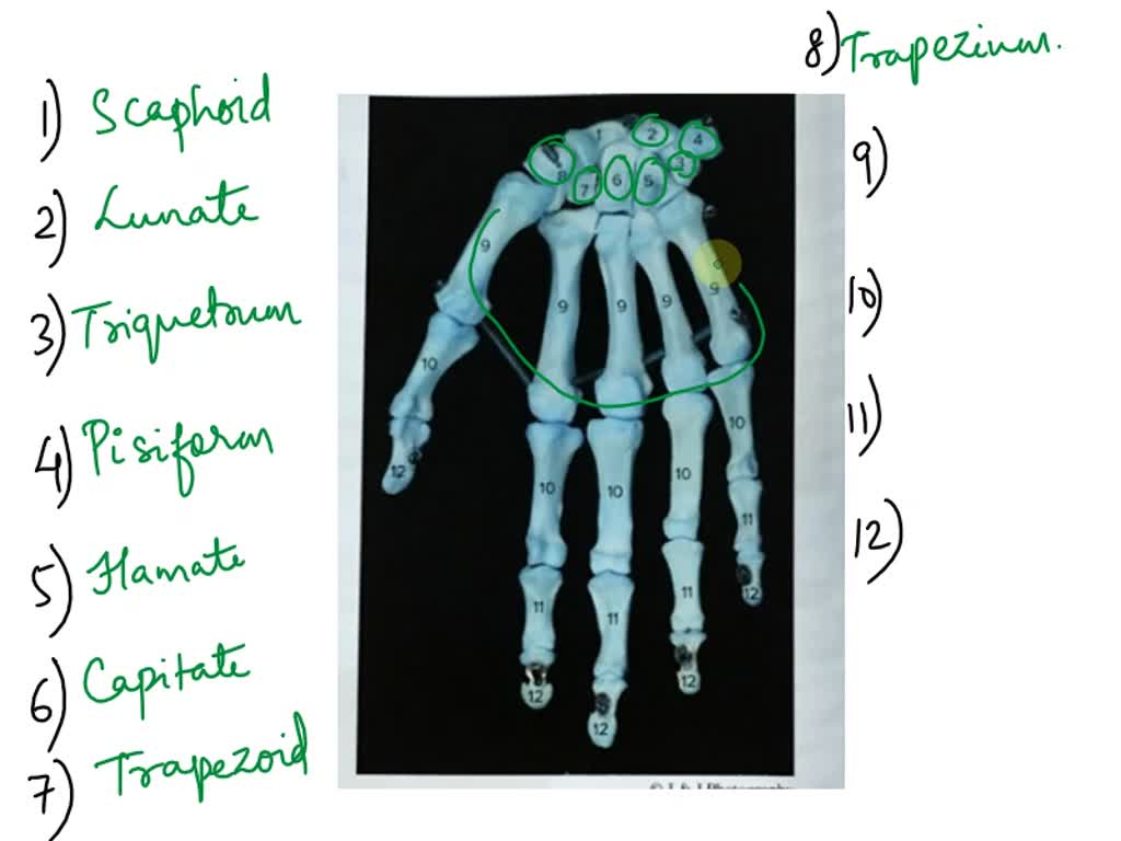 SOLVED: Numbered on this anterior view of the right hand by placing the ...
