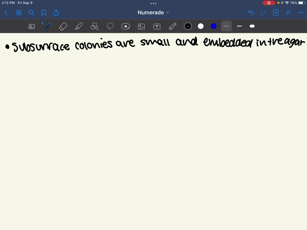 SOLVED: Describe the difference between the appearance of surface and ...