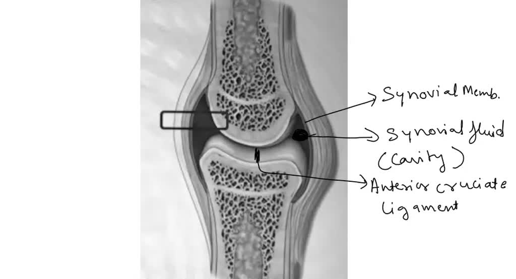 SOLVED: Fiace the synovial joint structures visuallzed in the red ...