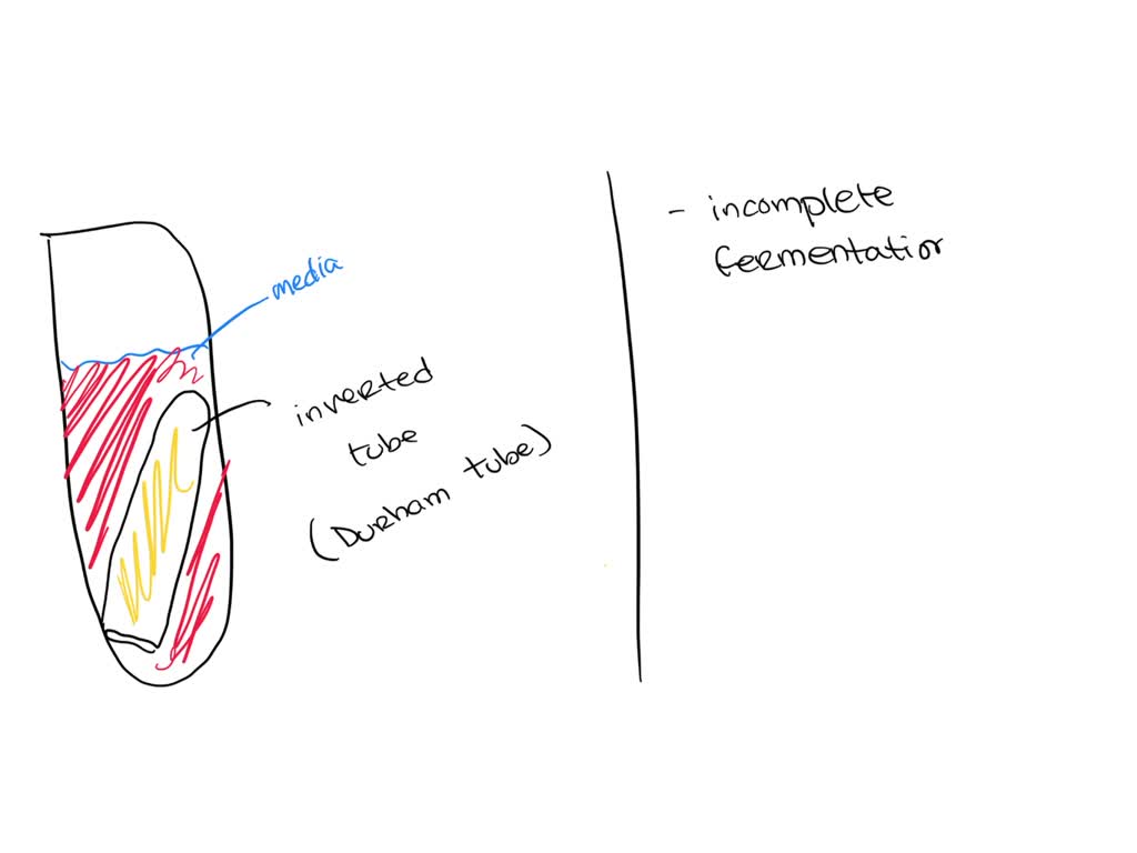 SOLVED: Consider the image below. You inoculate a PR glucose broth, and ...