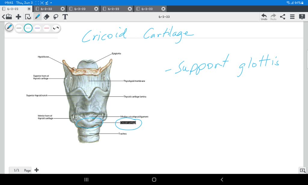 SOLVED: Which of these structures forms a complete ring around the ...