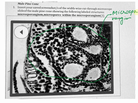 Female Pine Cone Microscope
