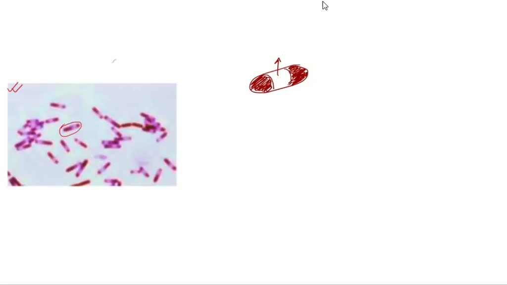 SOLVED: You are working with a patient with severe, bloody diarrhea ...