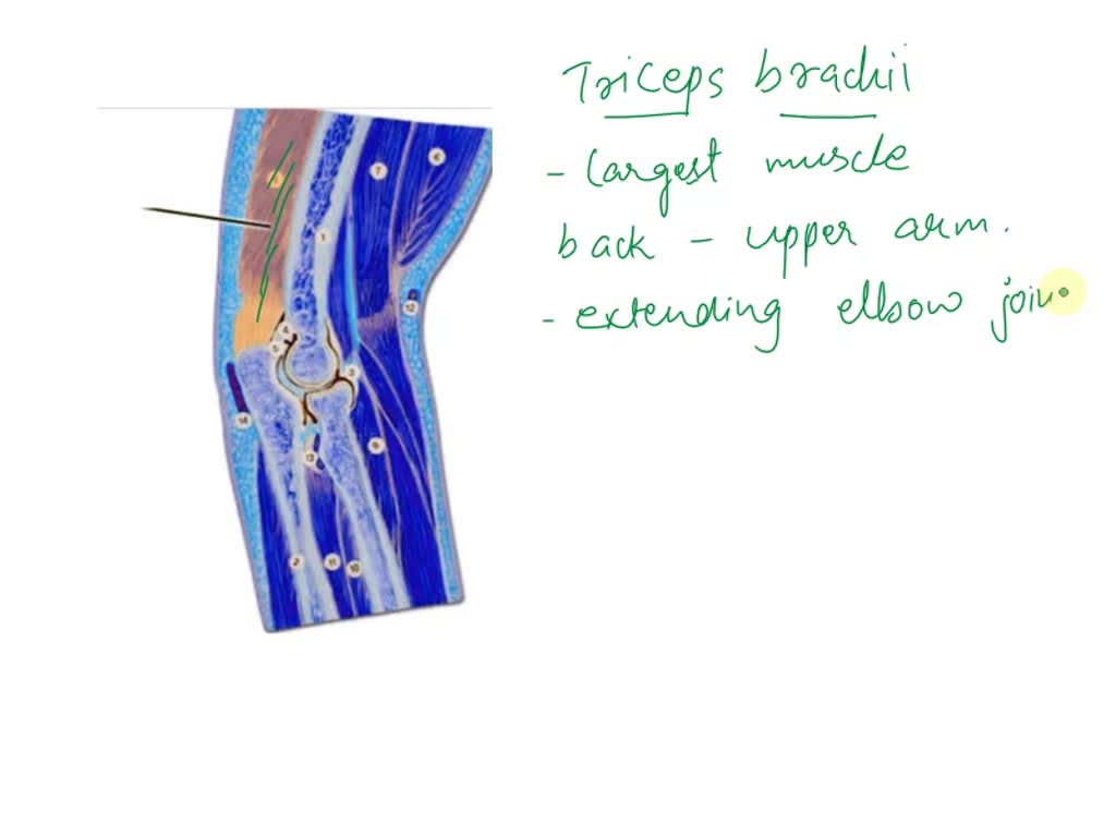 SOLVED: Arm muscle EMG activity .. Which muscles of the forearm, the ...