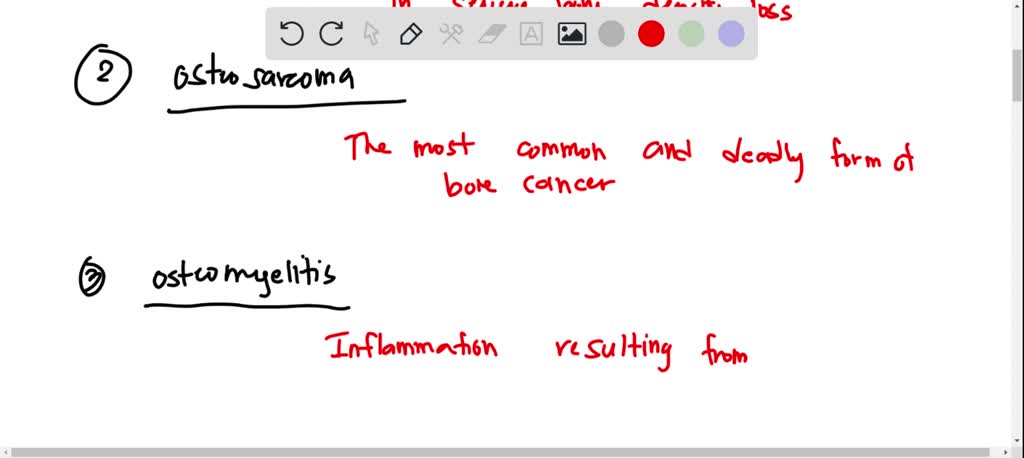 SOLVED: Calculate MAIS, ISS, NISS, and POD for the following people and ...