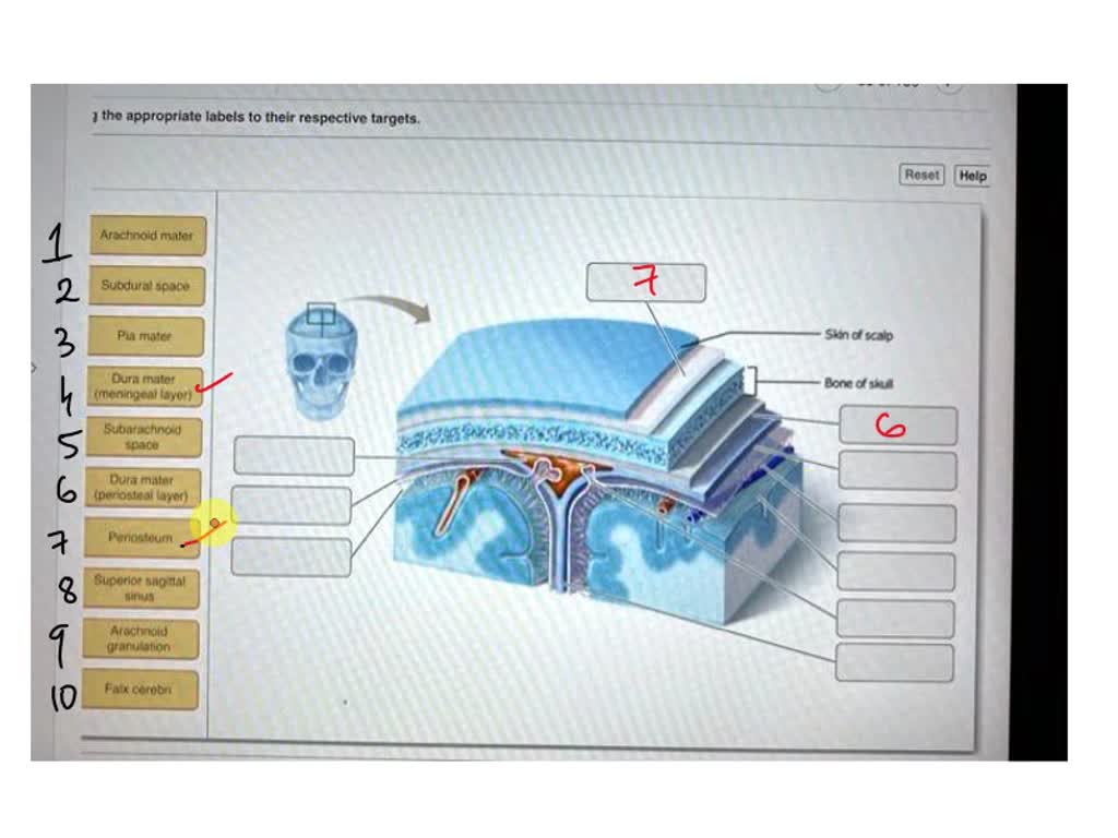 SOLVED: Drag the appropriate labels to their respective targets. Reset Help Epidural space ...