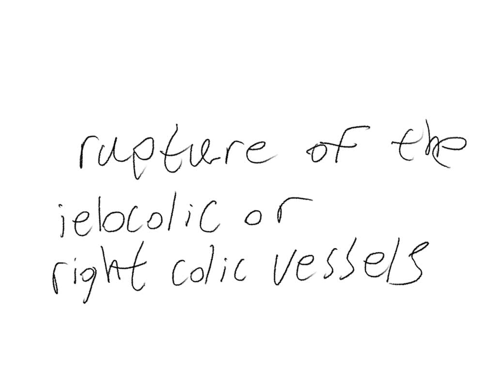 SOLVED: When severe hemorrhage occurs during right colon mobilization ...