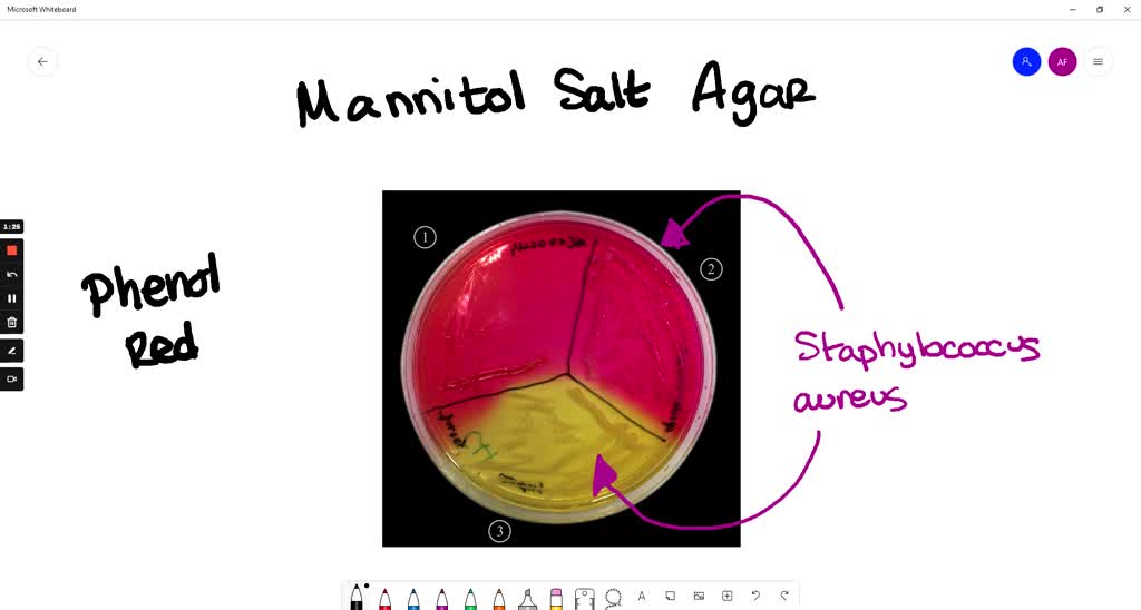 SOLVED: Nutrient agar Blood agar PEA Mannitol salt MacConkey Gram stain
