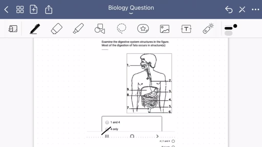 SOLVED: Examine the digestive system structures in the figure Most of the digestion of fats ...