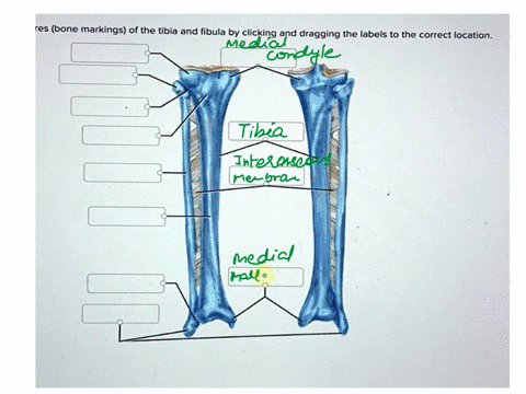Label the bones and bony markings of the lower leg. Labels Drop Zones Head of fibula Greater ...