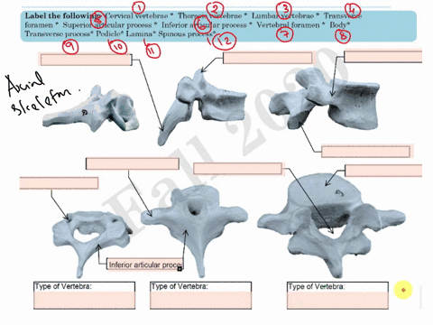 ACTIVITY 2 - ANATOMICAL FEATURES OF THE AXIAL SKELETON Part...