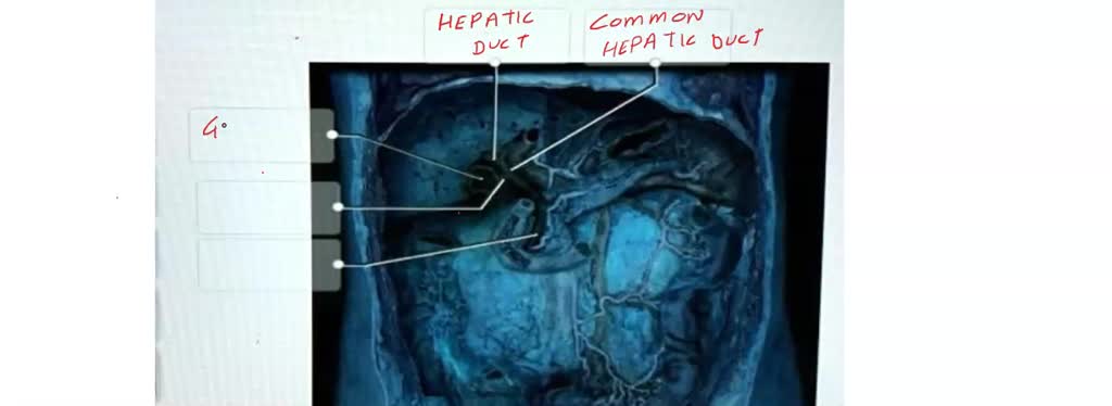 SOLVED: Label the abdominal contents using the hints provided. Stomach ...