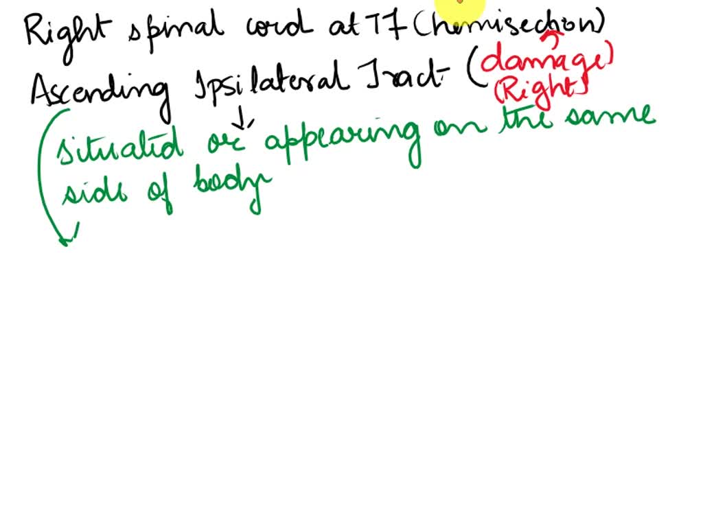 SOLVED: A lesion to the left ventral horn of the spinal cord (and ONLY ...