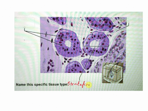 [GET ANSWER] identifying connective tissue tendon correctly identify ...