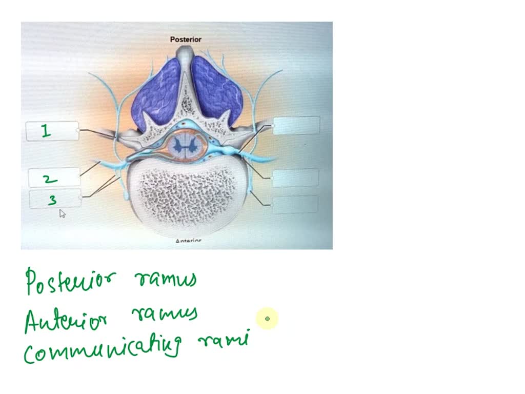 SOLVED: Identifying the Anatomical Components of a Spinal Nerve ...