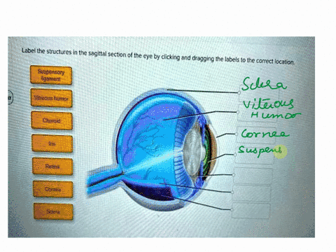 Label the structures in the sagittal section of the eye by...
