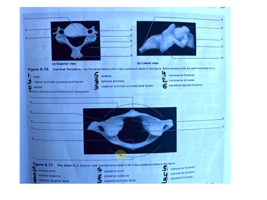 SOLVED: 4.a In the space below, draw a cervical (C3-C7), thoracic, and ...