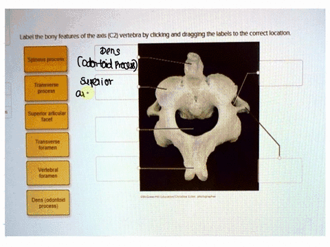 (Chp 27-29) Label the cross-section of the spinal cord and...