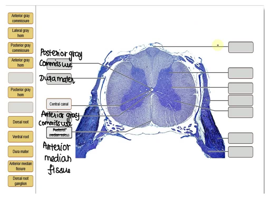 SOLVED: Help with this problem? I really have no clue :( Anterior gray ...