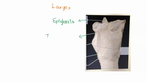 Label the structures of the larynx anterior and posterior views by ...