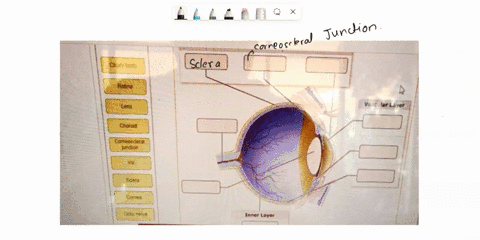Art-labeling Activity: The Sectional Anatomy of the Eye (Superior View ...